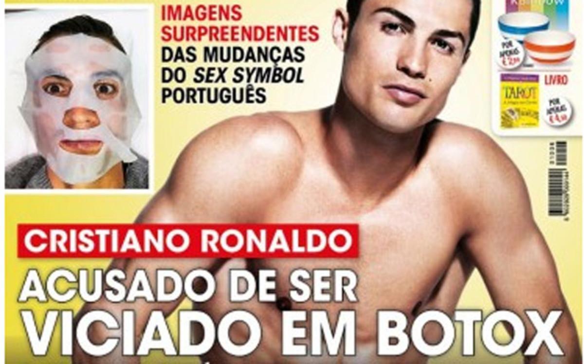 Cristiano Ronaldo, adicto al botox